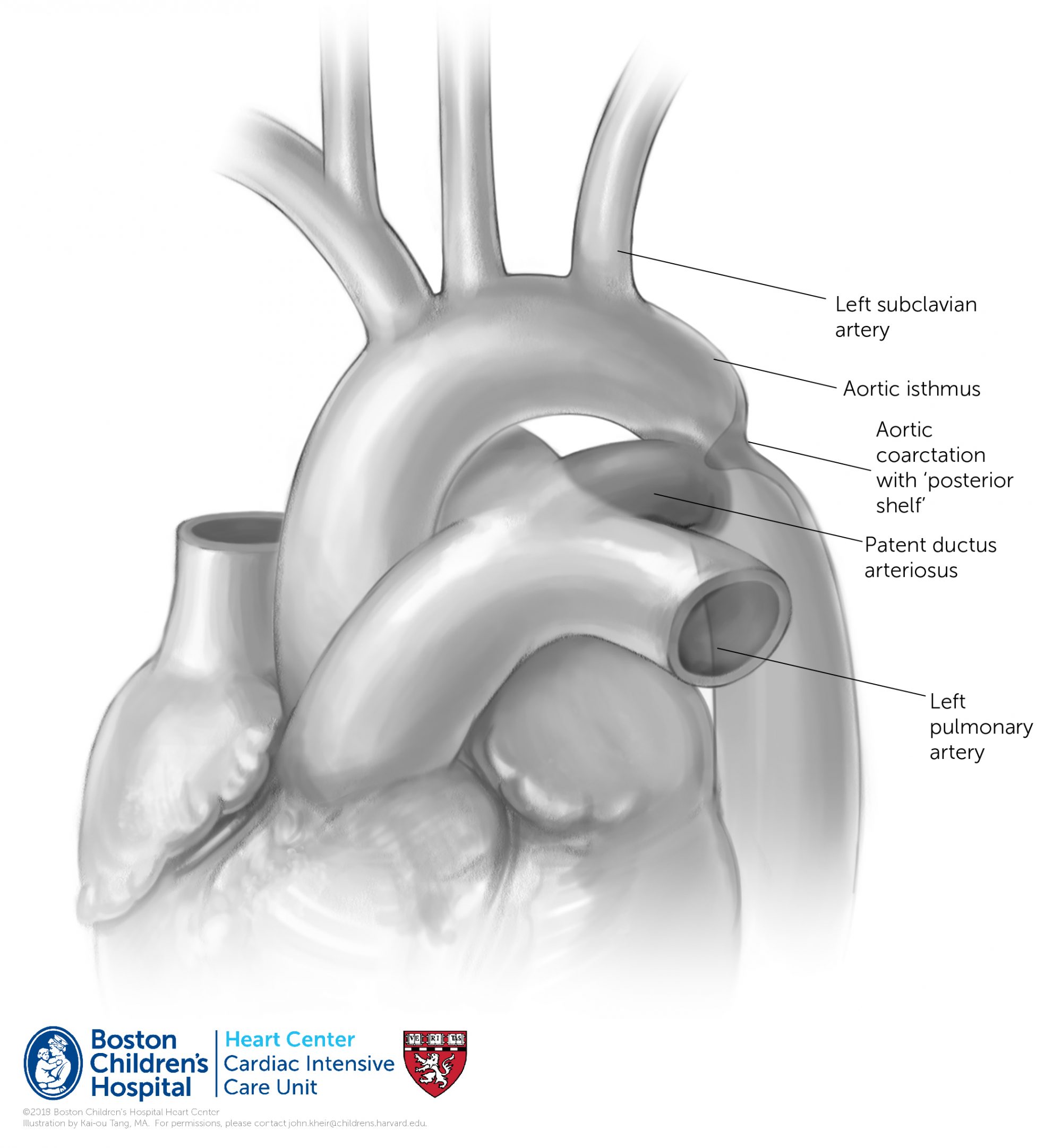 Isolated CoA – Online supplement