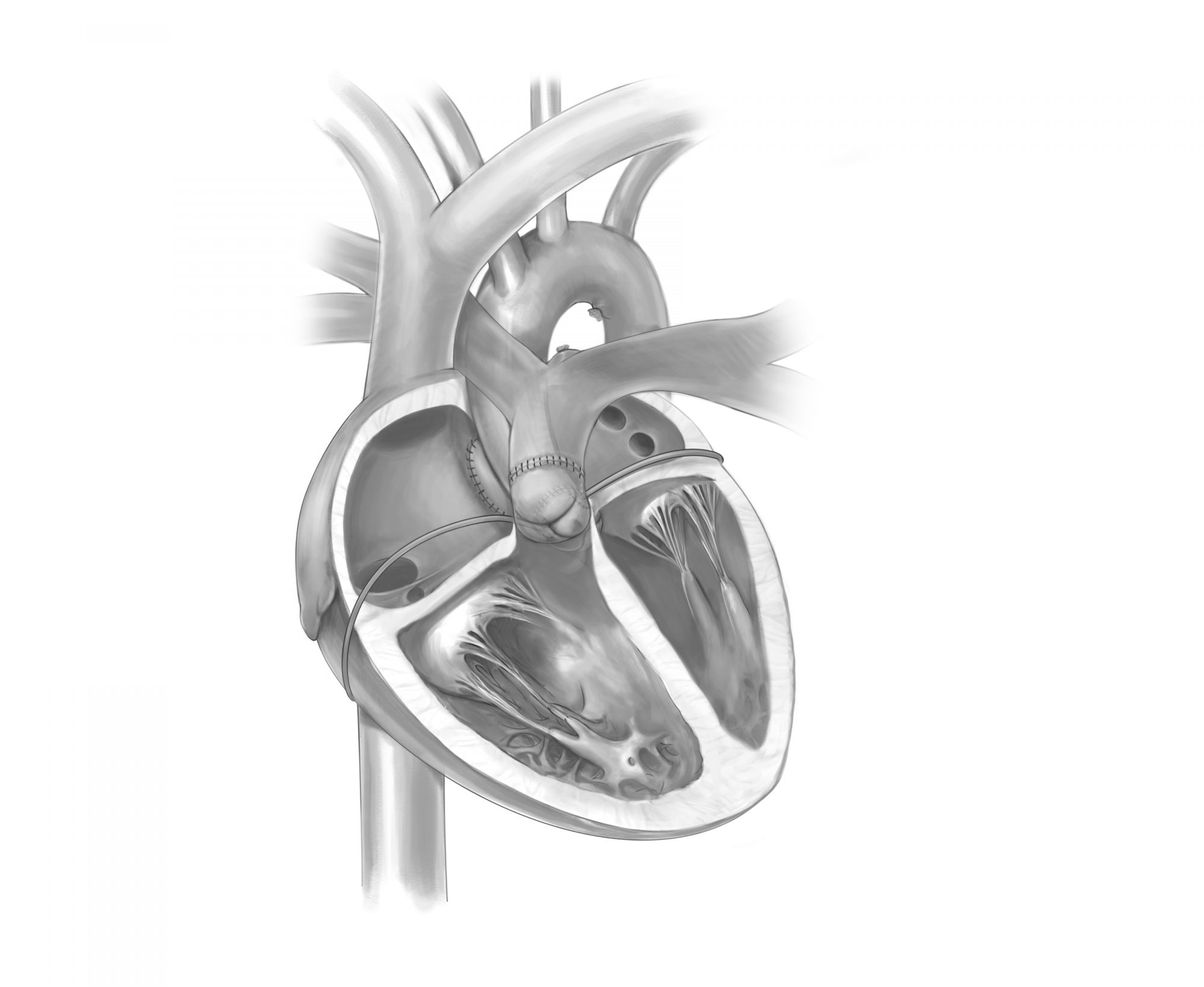 dTGA/IVS – Online supplement