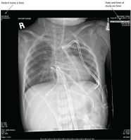 Interpreting A CXR Online Supplement Interpreting A CXR Online Supplement