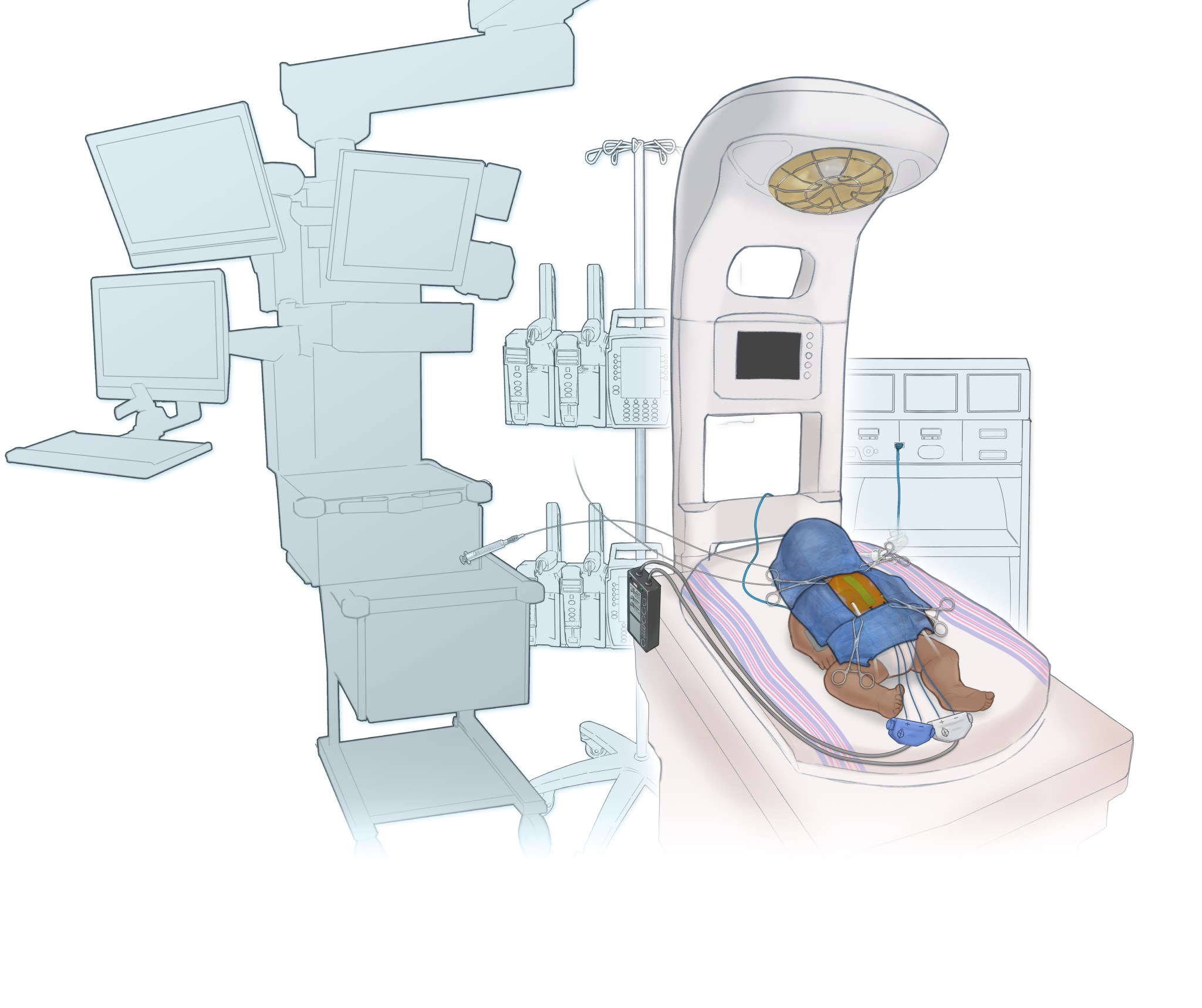 ECMO – Online supplement