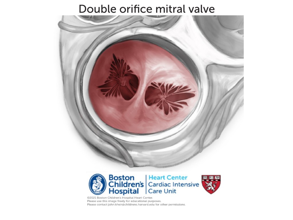 Mitral Valve Pathologies Online Supplement