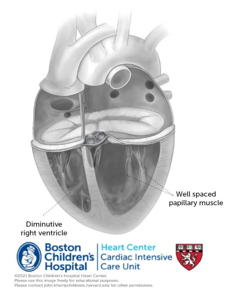CAVC Spectrum – Online supplement