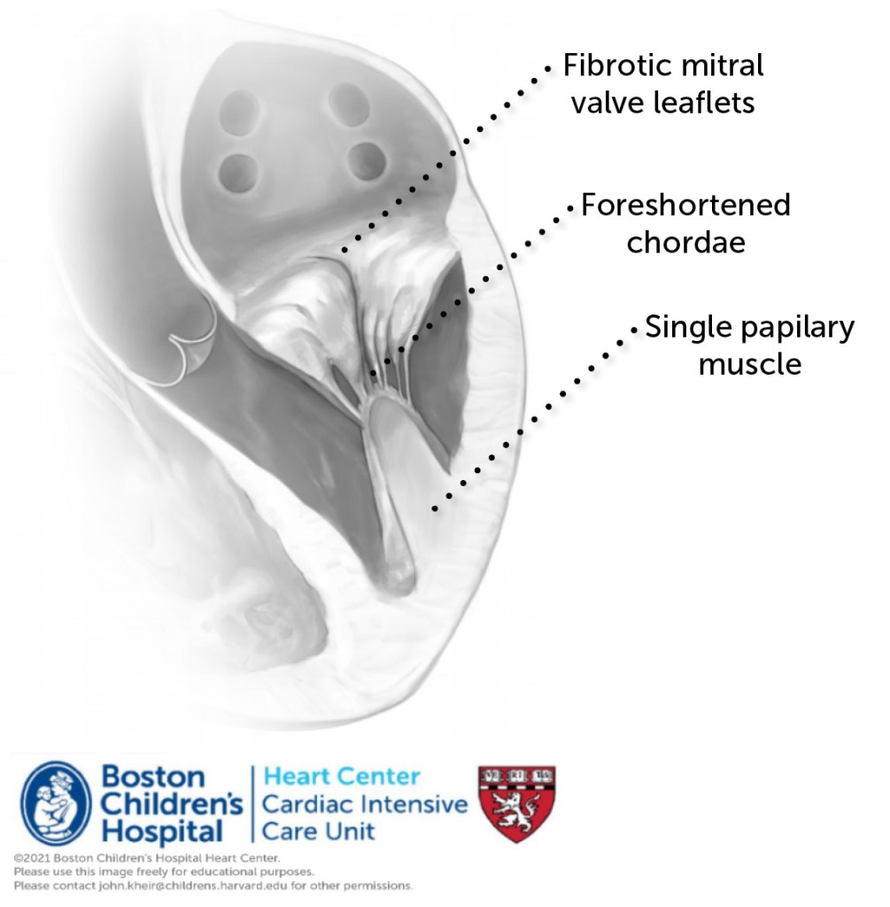 Mitral Arcade – Online supplement