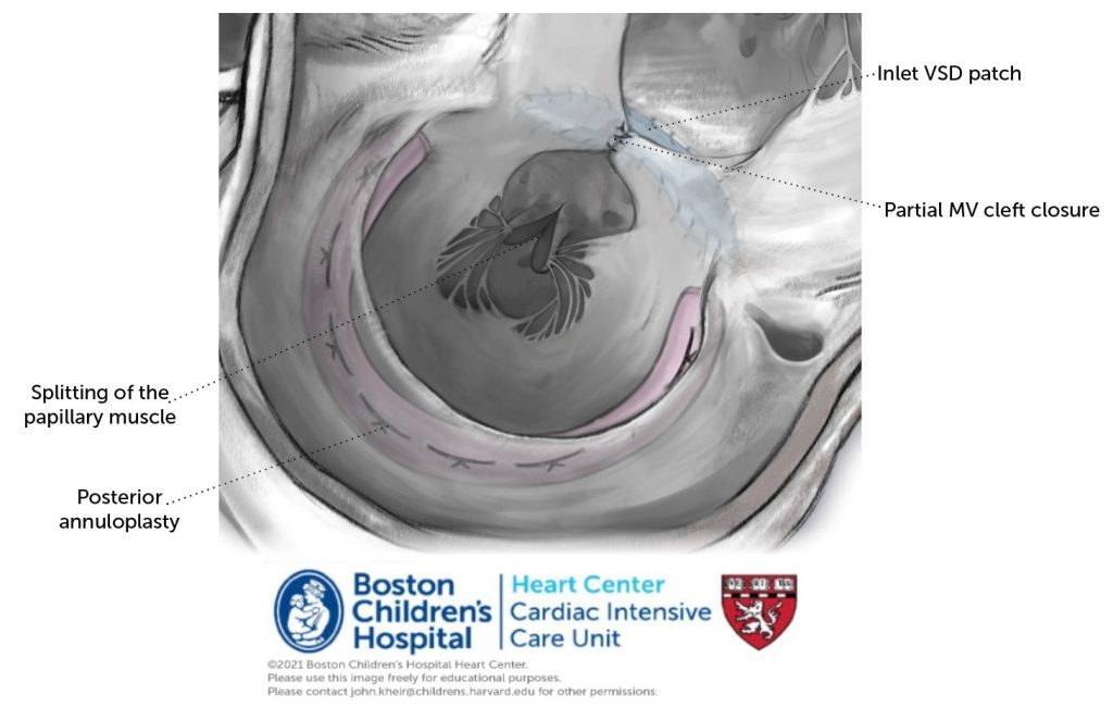 CAVC Spectrum – Online supplement