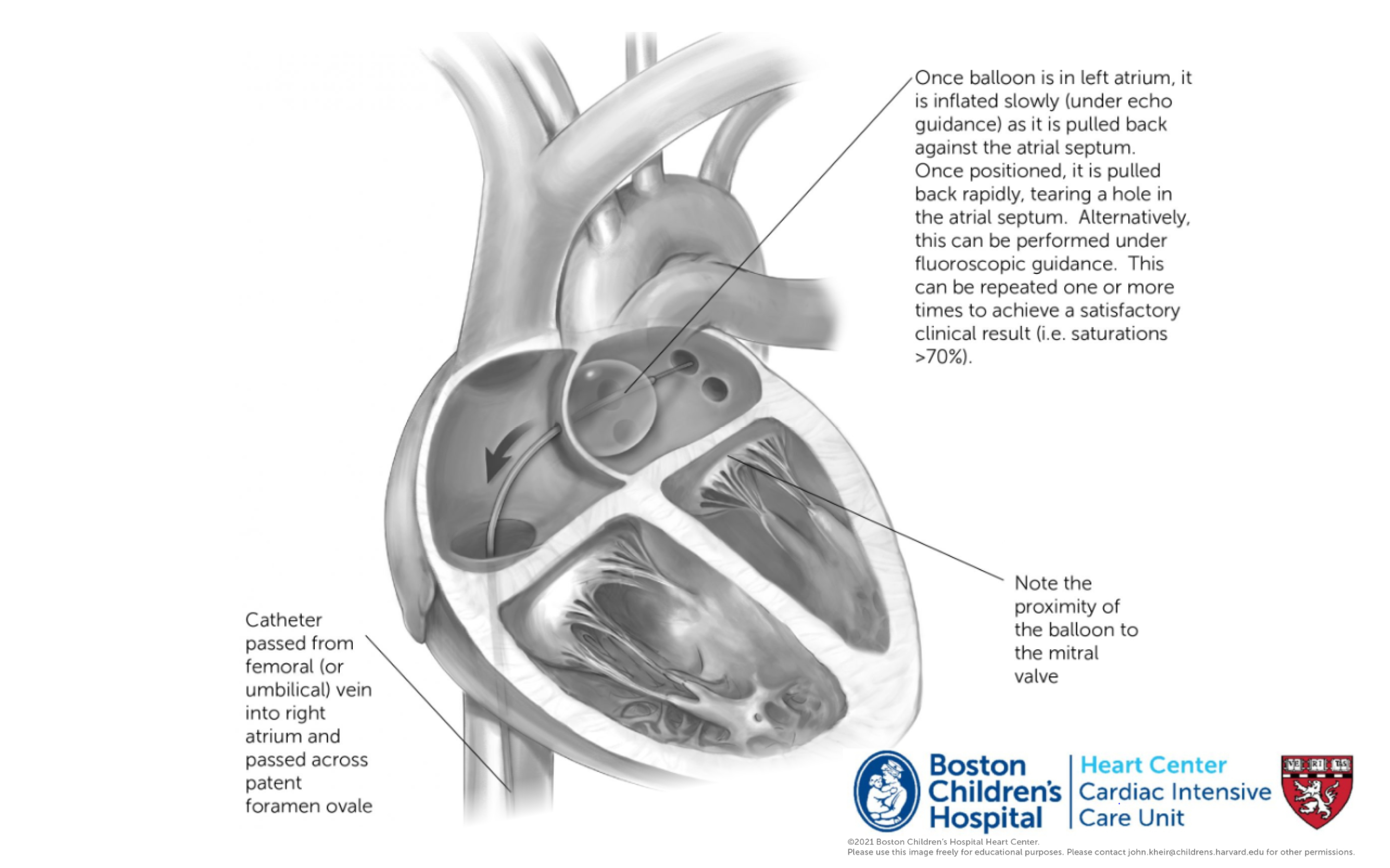 dTGA/IVS – Online supplement