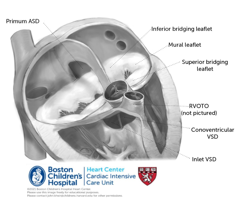 TOF/CAVC – Online supplement