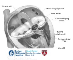 TOF/CAVC – Online supplement