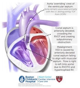 TOF/PS – Online supplement