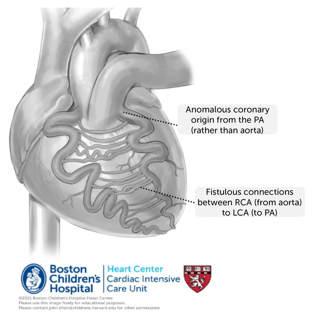 ALCAPA – Online supplement