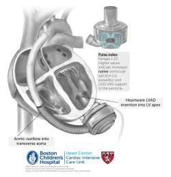 HeartMate III – Online supplement