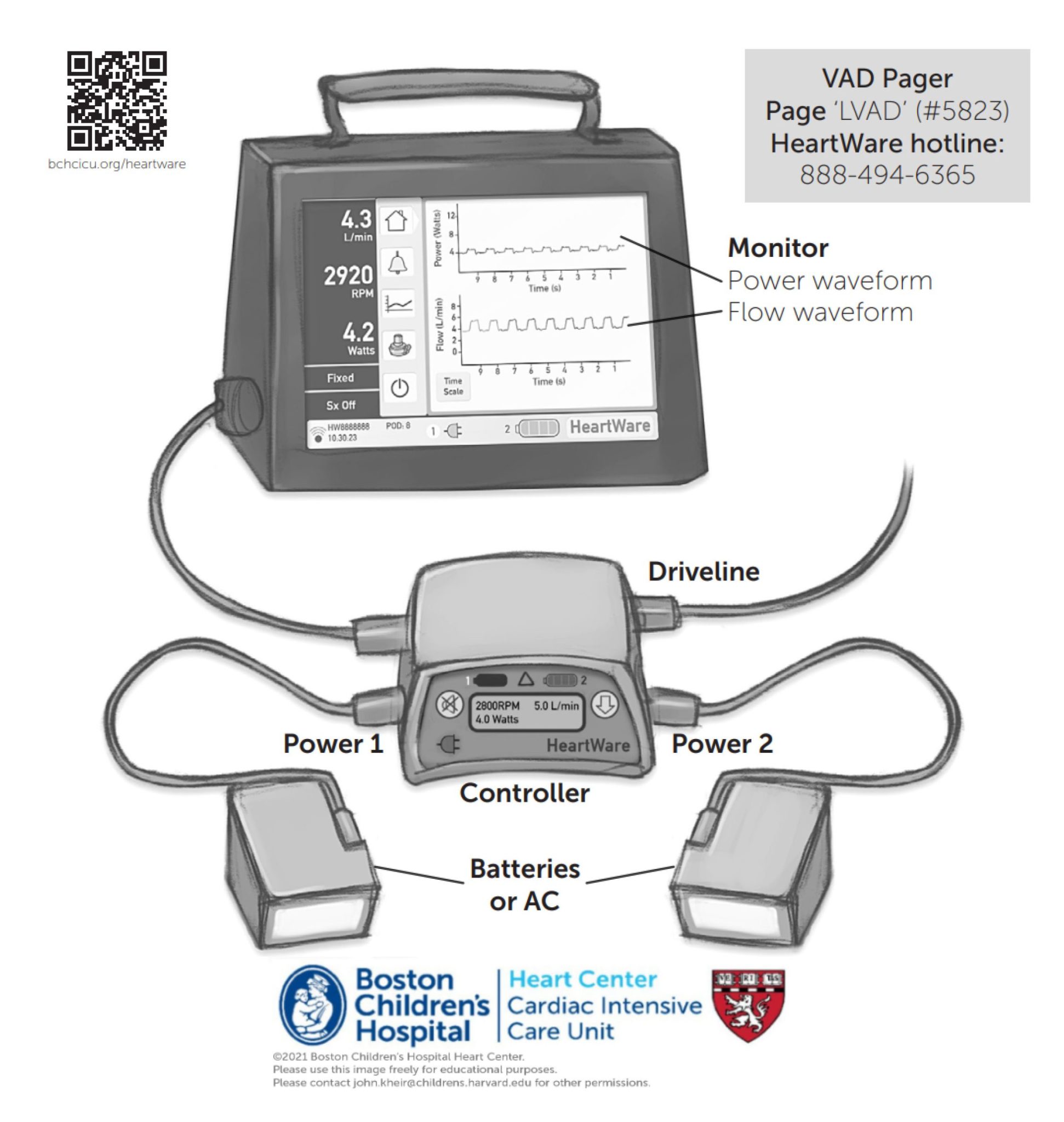 Heartware LVAD – Online supplement