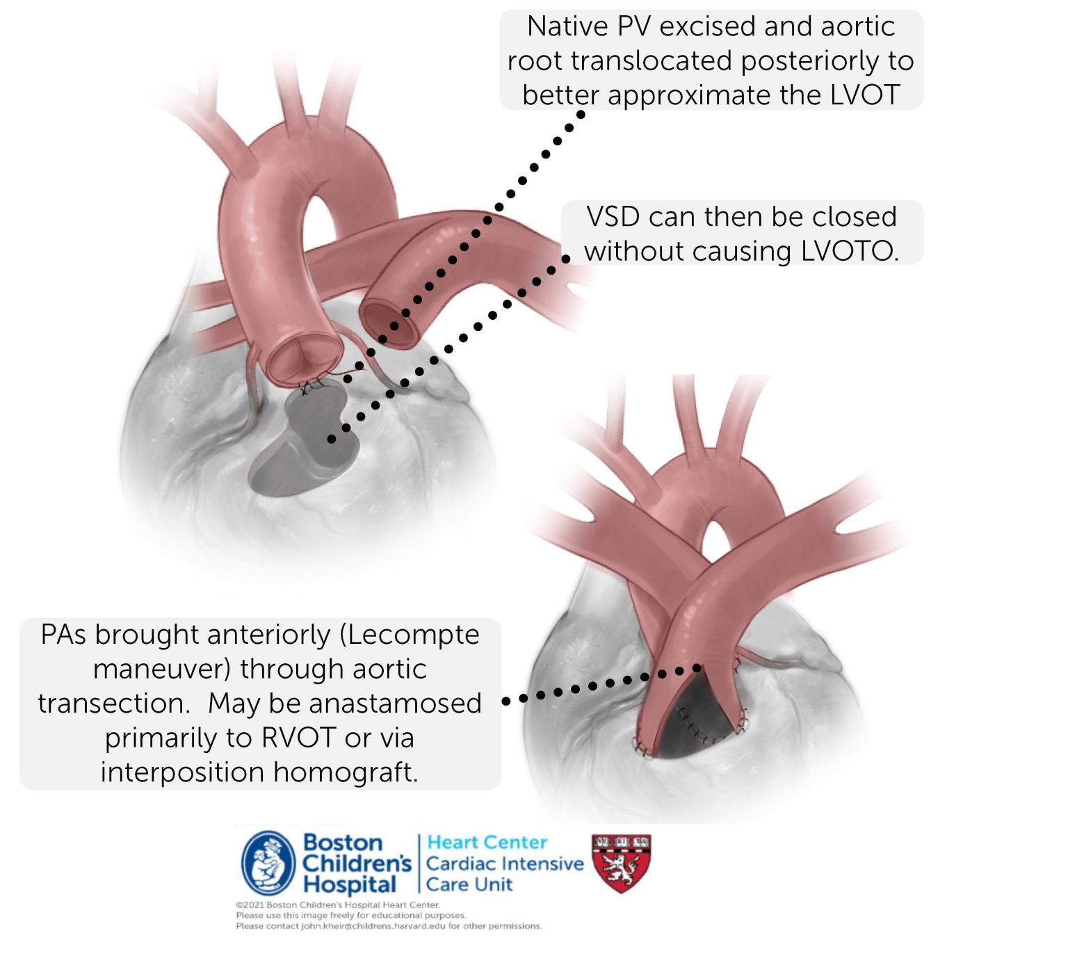 dTGA/VSD/PS – Online supplement