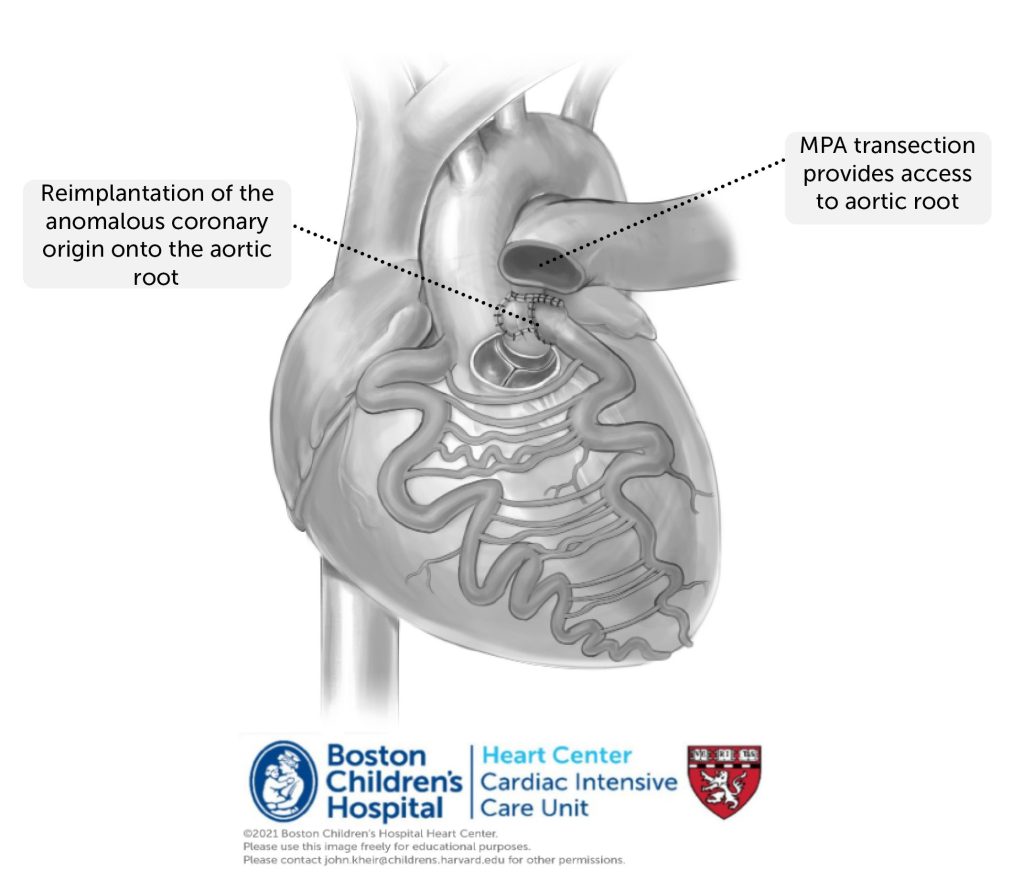 ALCAPA – Online supplement