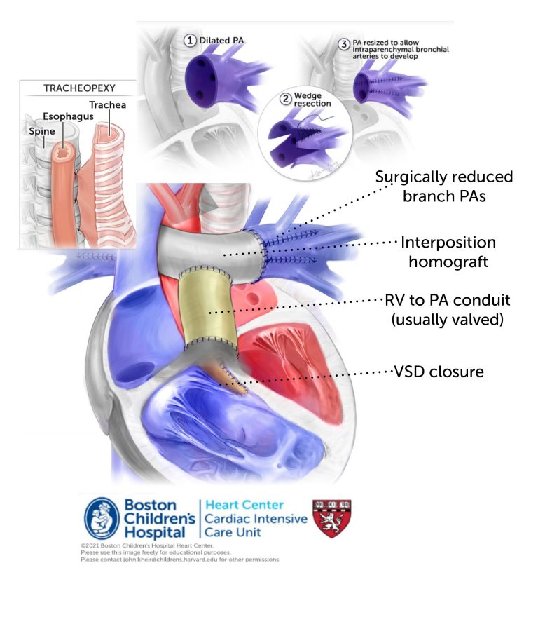 TOF/APV – Online supplement