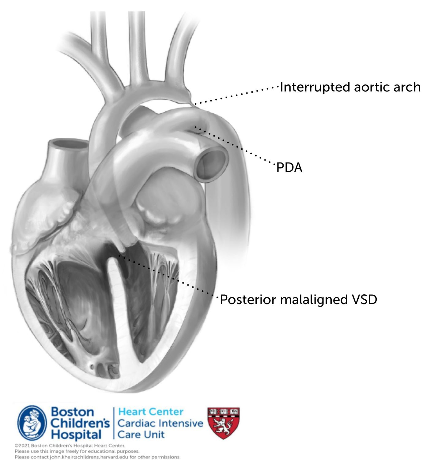VSD/IAA – Online supplement